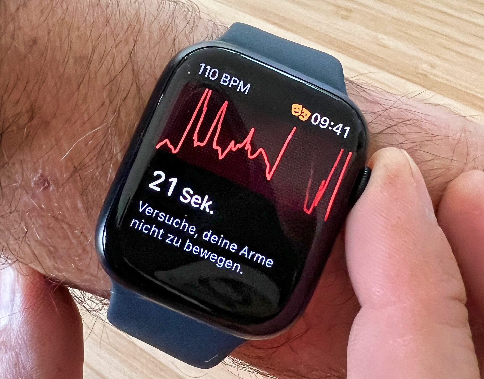 How To Measure Blood Pressure With Apple Watch Series Peacecommission
